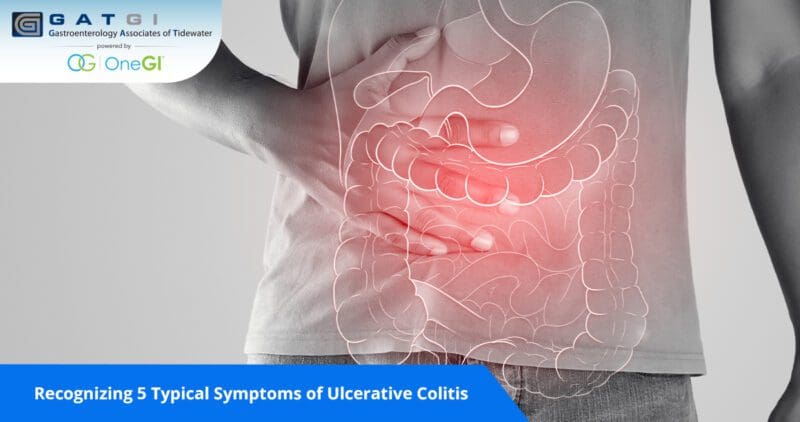 Recognizing 5 Typical Symptoms of Ulcerative Colitis