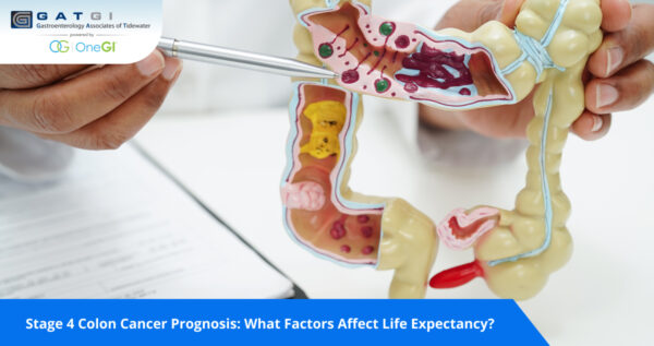Stage 4 Colon Cancer Prognosis: What Factors Affect Life Expectancy?
