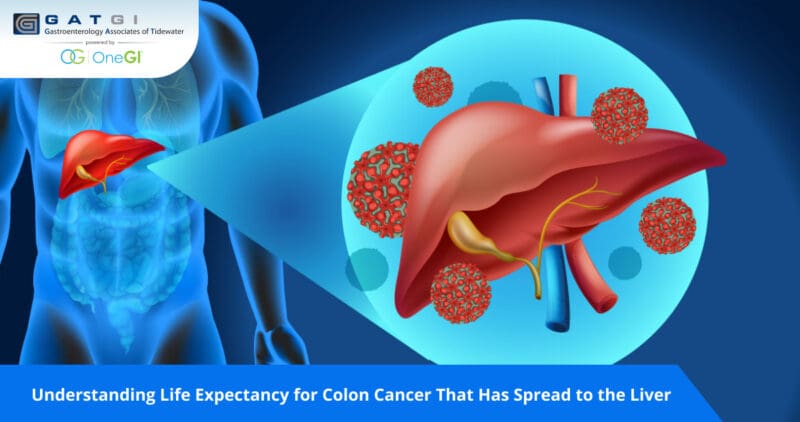 Stage 4 Colon Cancer Prognosis: What Factors Affect Life Expectancy?